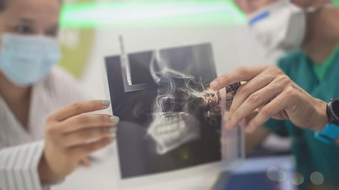 Corrective Jaw Surgery – Starr General Dentistry